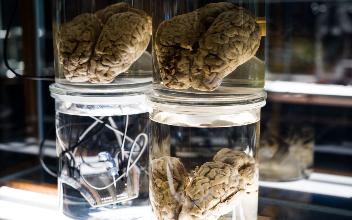 Ani Liu with Mario Maas, Matthias Cabri and Onno Baur - Bio Art ...